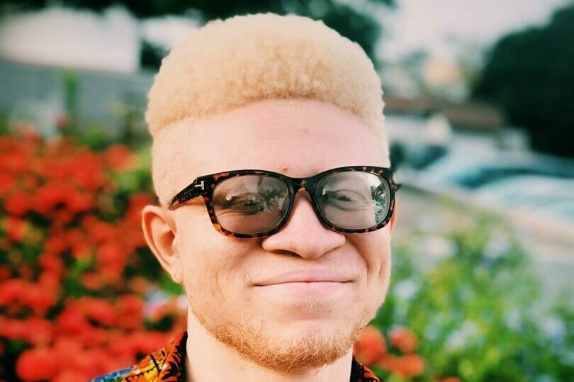 Access to Exchange Externship Alumni Highlights - MIUSA